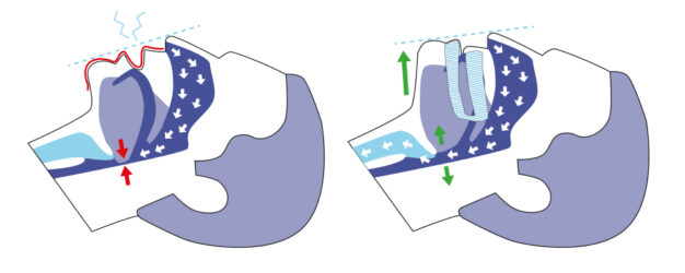 Les orthèses d’avancée mandibulaire en pratique – Guide 2023